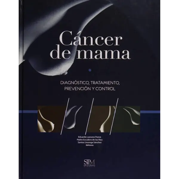 Libro Cáncer de Mama Diagnóstico, prevención y control | Estadio ...